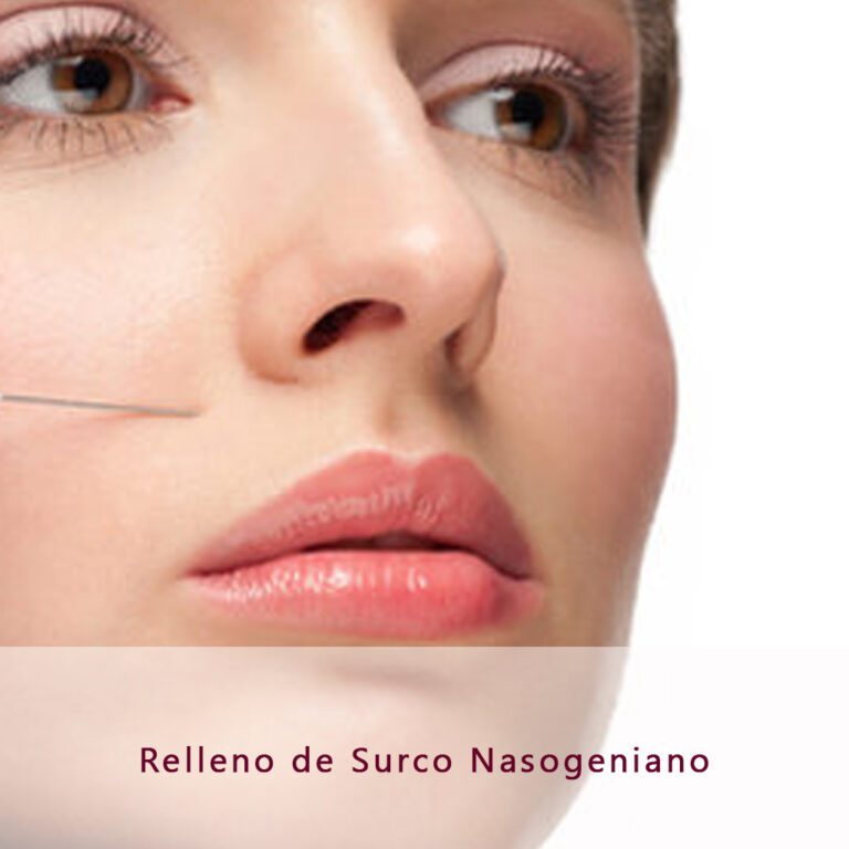 Relleno de surco nasogeniano - Aikya